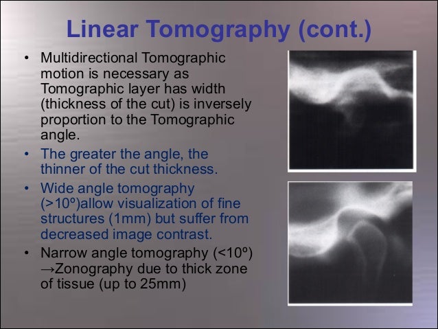 Specialised Techniques in Oral Radiology
