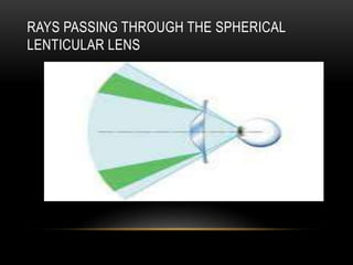 Special lens designing | PPTX