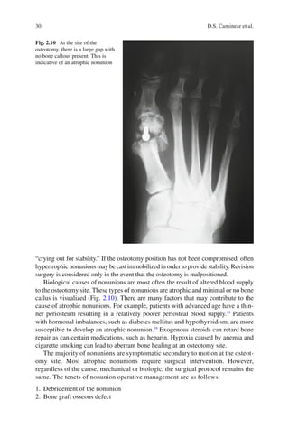 Special procedures in foot and ankle surgery | PDF