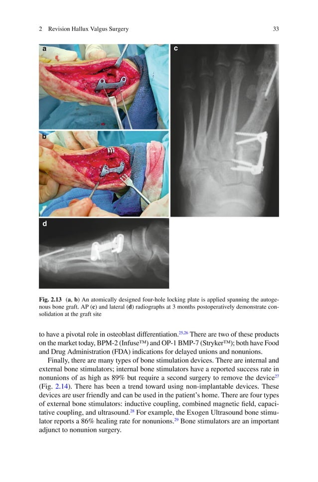 Special procedures in foot and ankle surgery | PDF