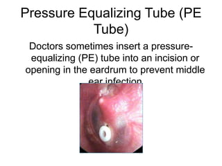 Special Senses | PPT