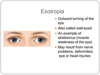 Special senses | PPT