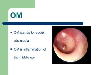 Special senses | PPT