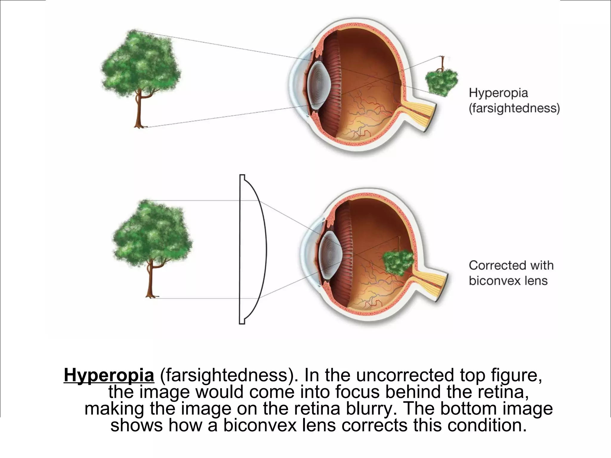 Eyes and Ears Medical Terminology | PPT