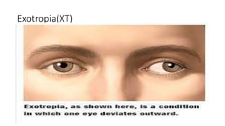 Special senses | PPTX | Ear, Nose and Throat Conditions | Diseases and ...