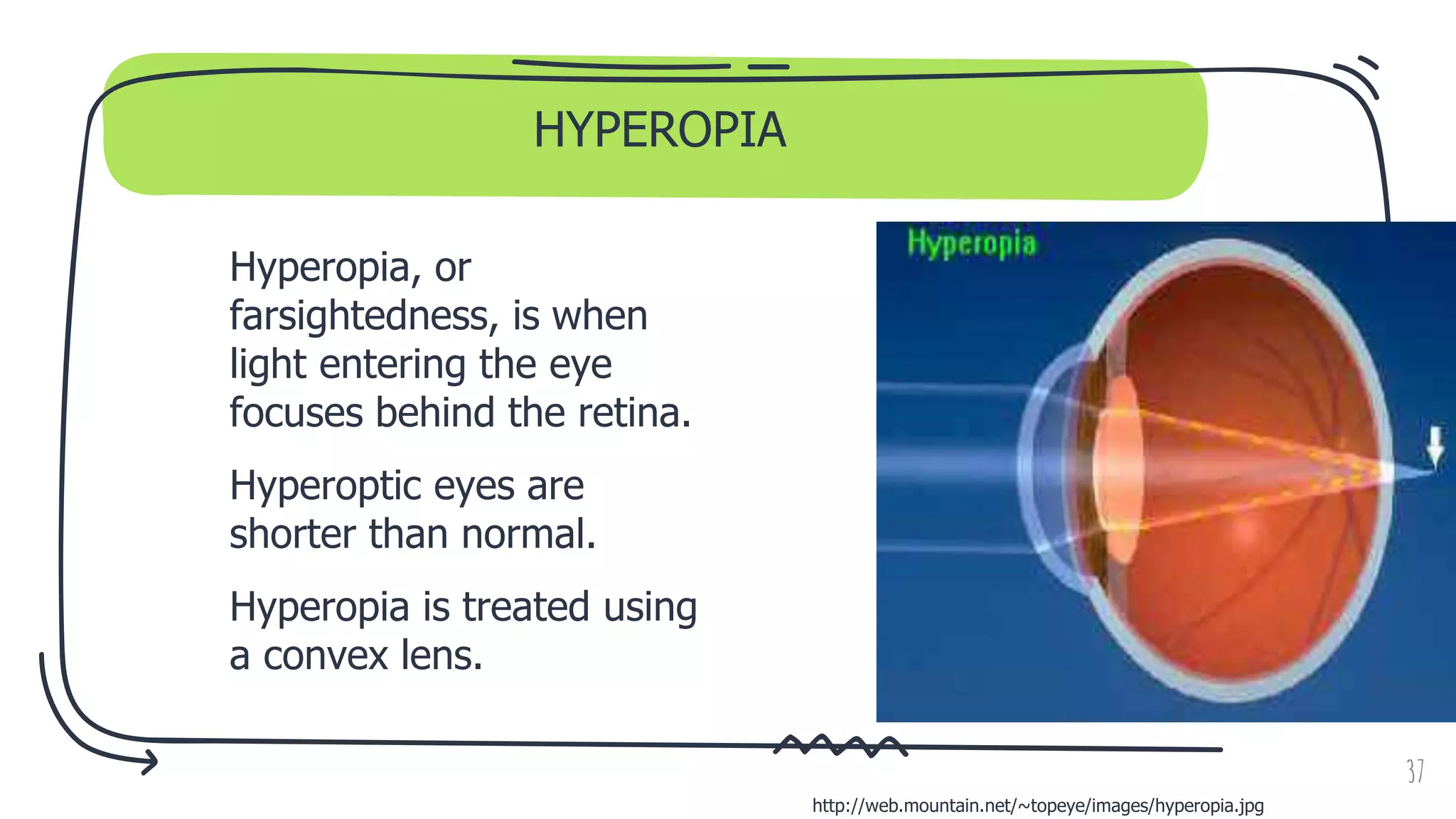Special senses | PPTX