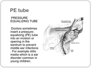 Special Senses Presen 13 | PPTX