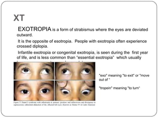 Special Senses Presen 13 | PPTX