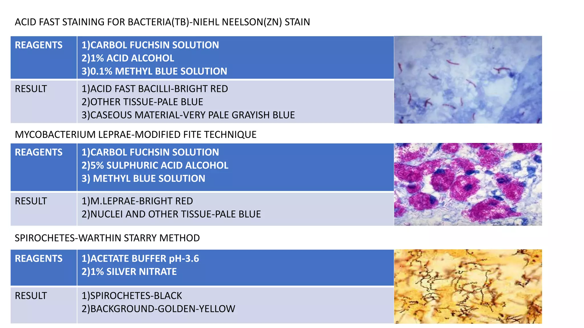 Special Stain.pptx