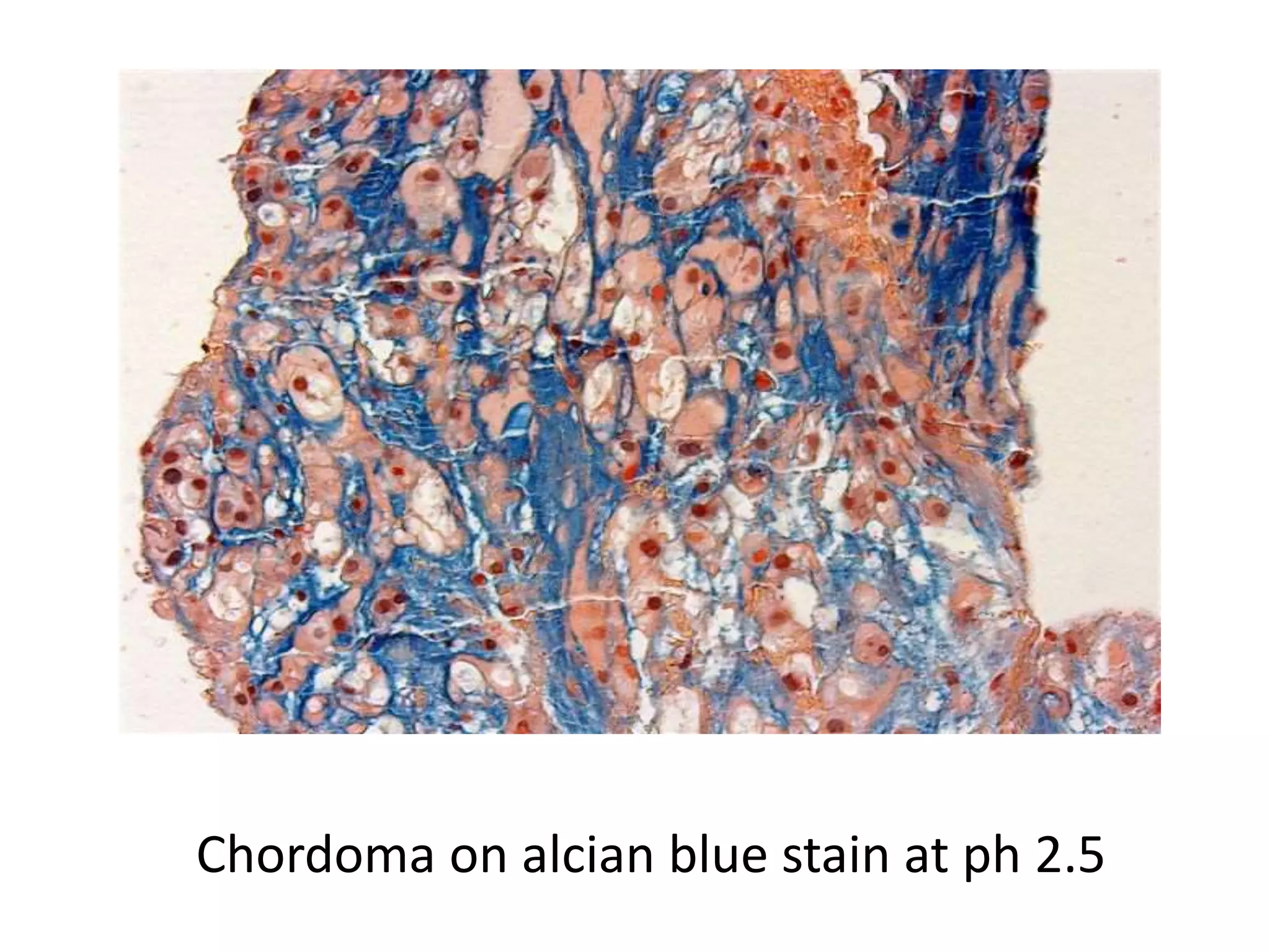 Special stain in histopathology | PPTX