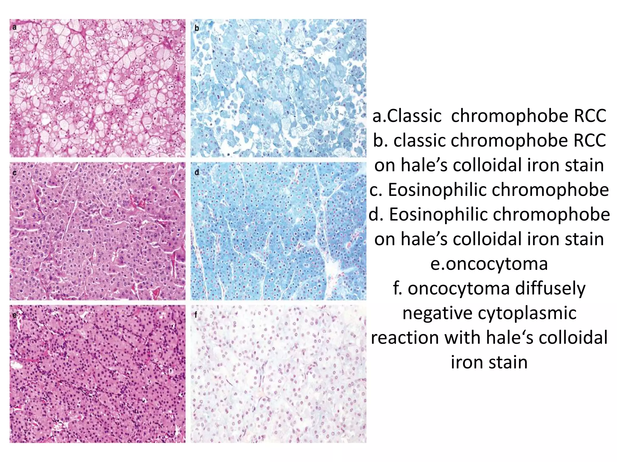 Special stain in histopathology | PPTX