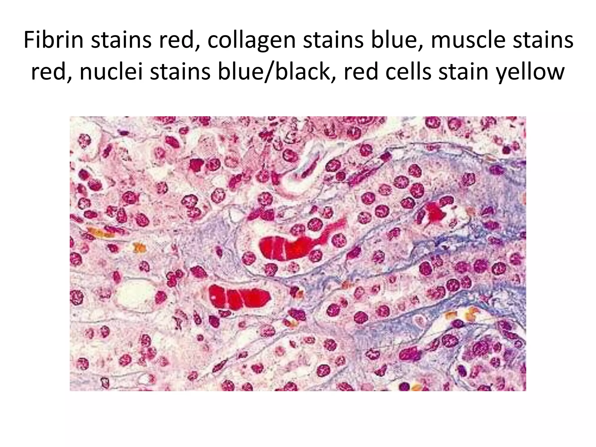 Special stain in histopathology | PPTX
