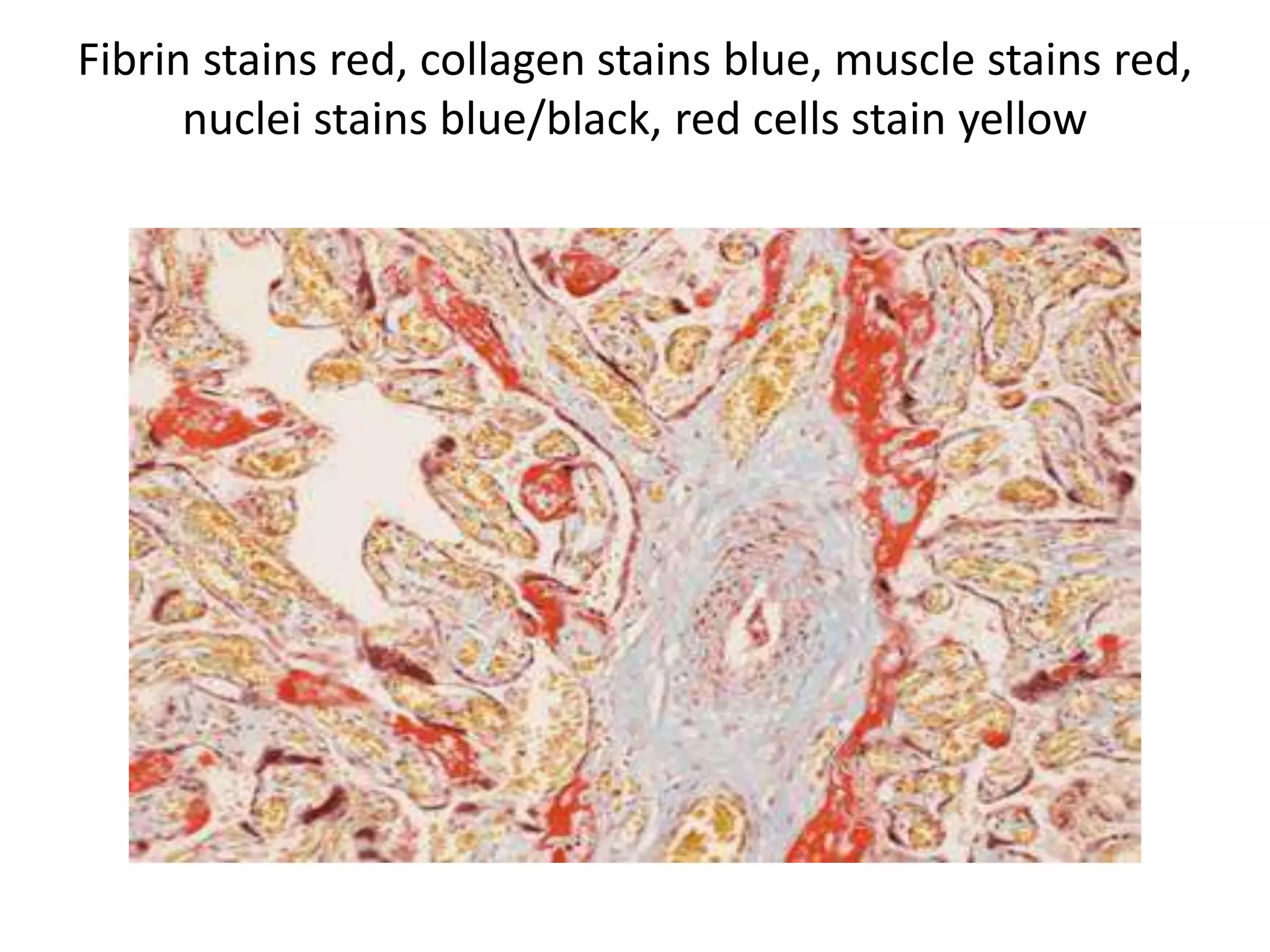 Special stain in histopathology | PPTX