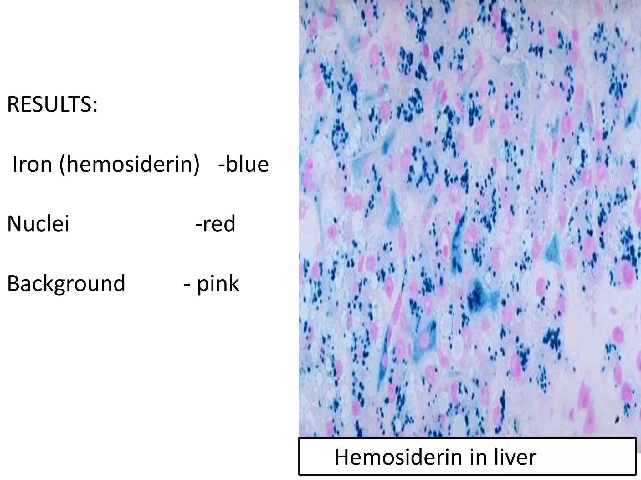 Special stain in histopathology | PPTX