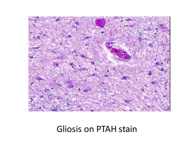 Special stain in histopathology