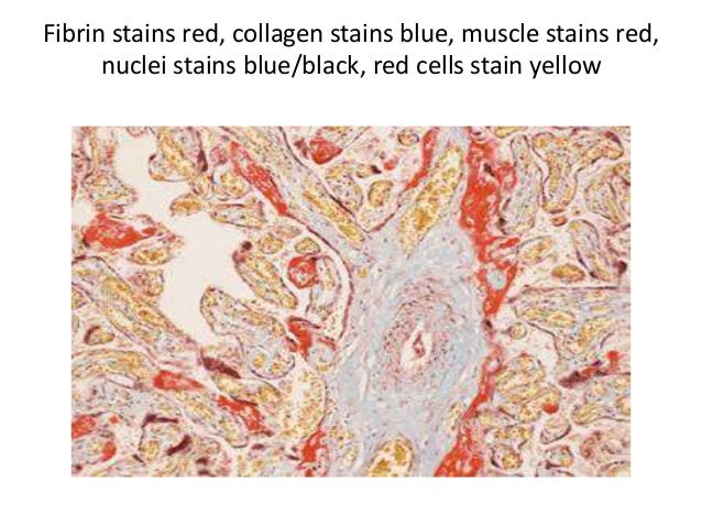Special stain in histopathology