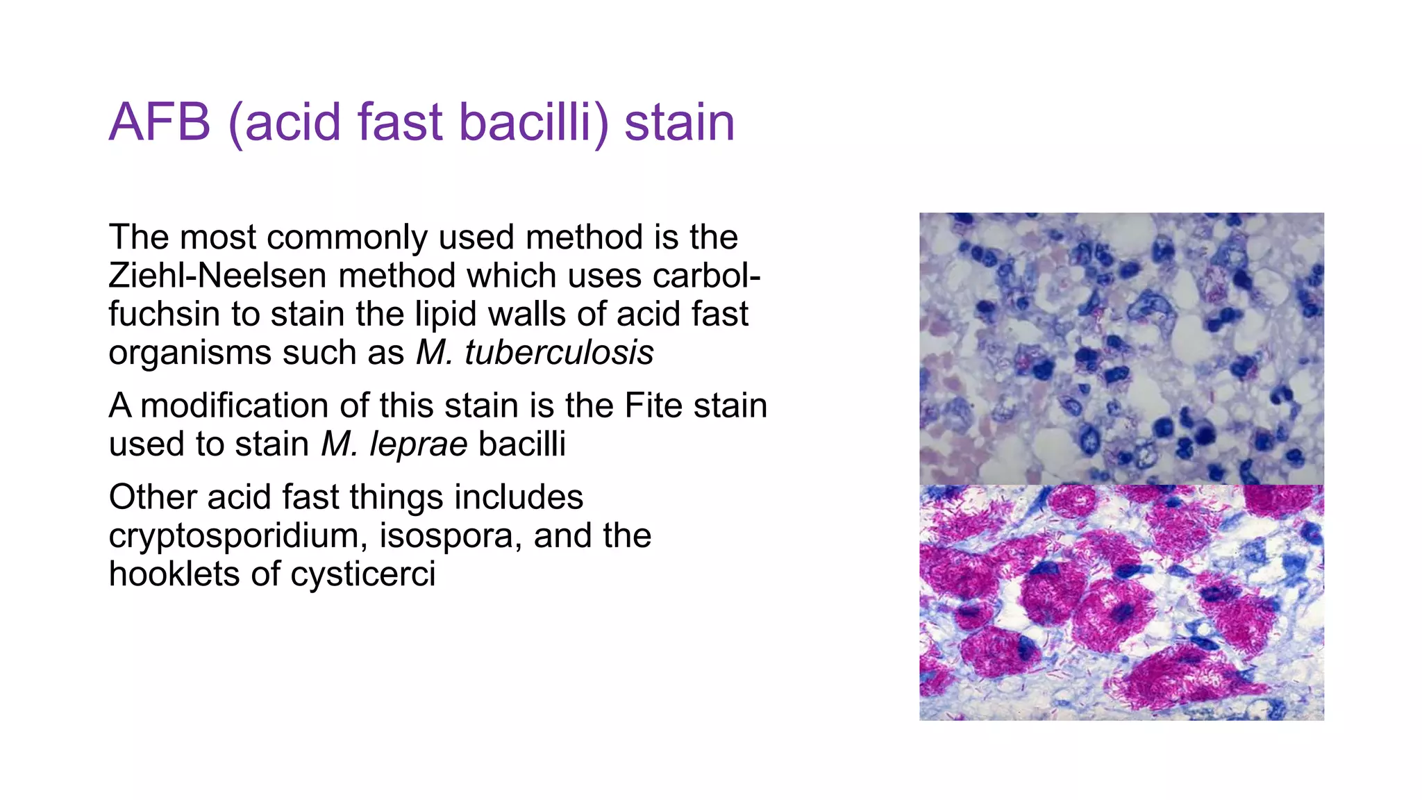 Special stains | PPTX
