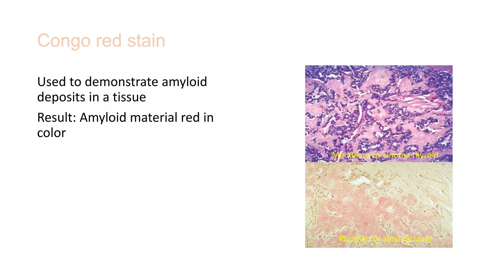 Special stains | PPTX