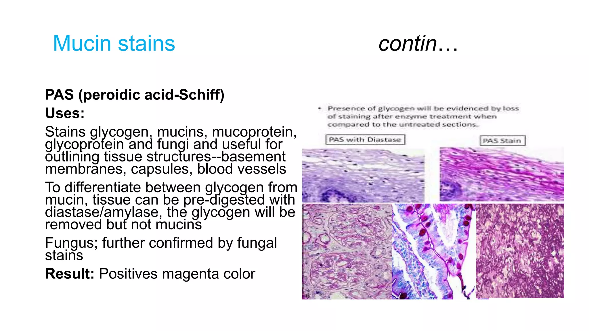 Special stains | PPTX