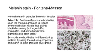 Special stains | PPTX