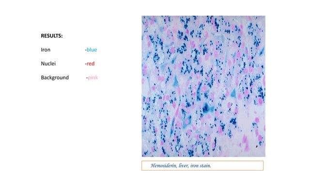 Special stains.pdf | Blood Disorders | Diseases and Conditions