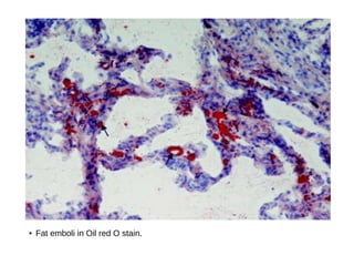 Special stains bmlt | ODP