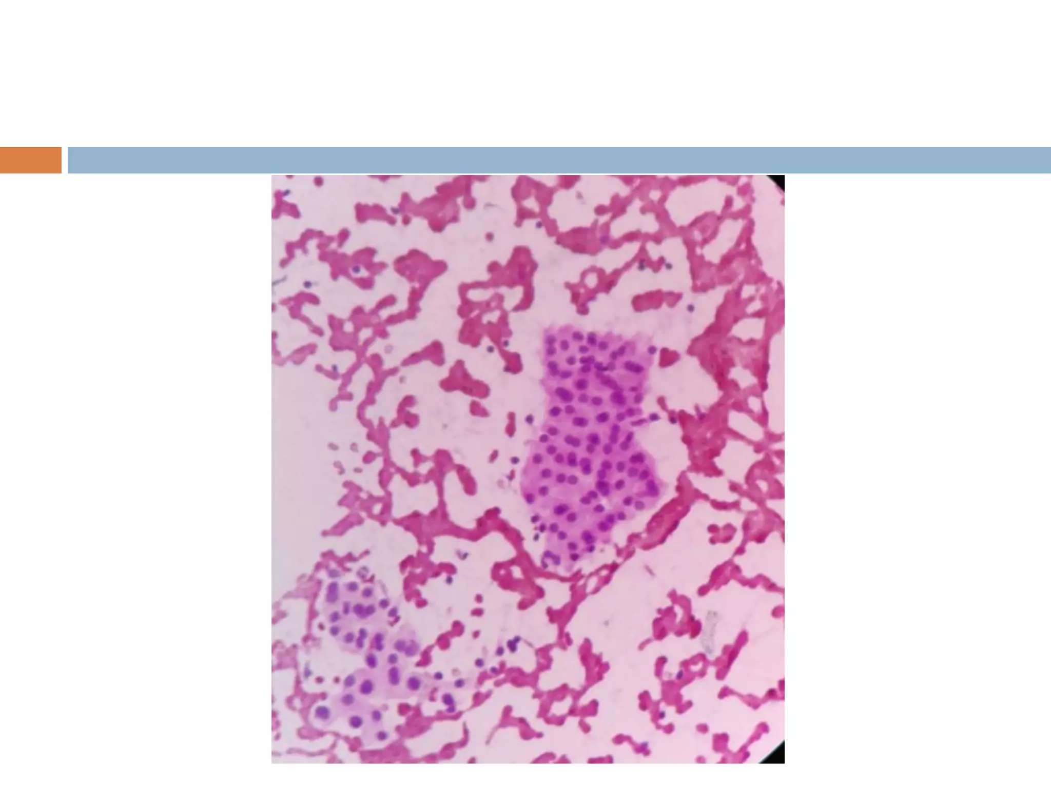 Special stains in cytology | PPTX