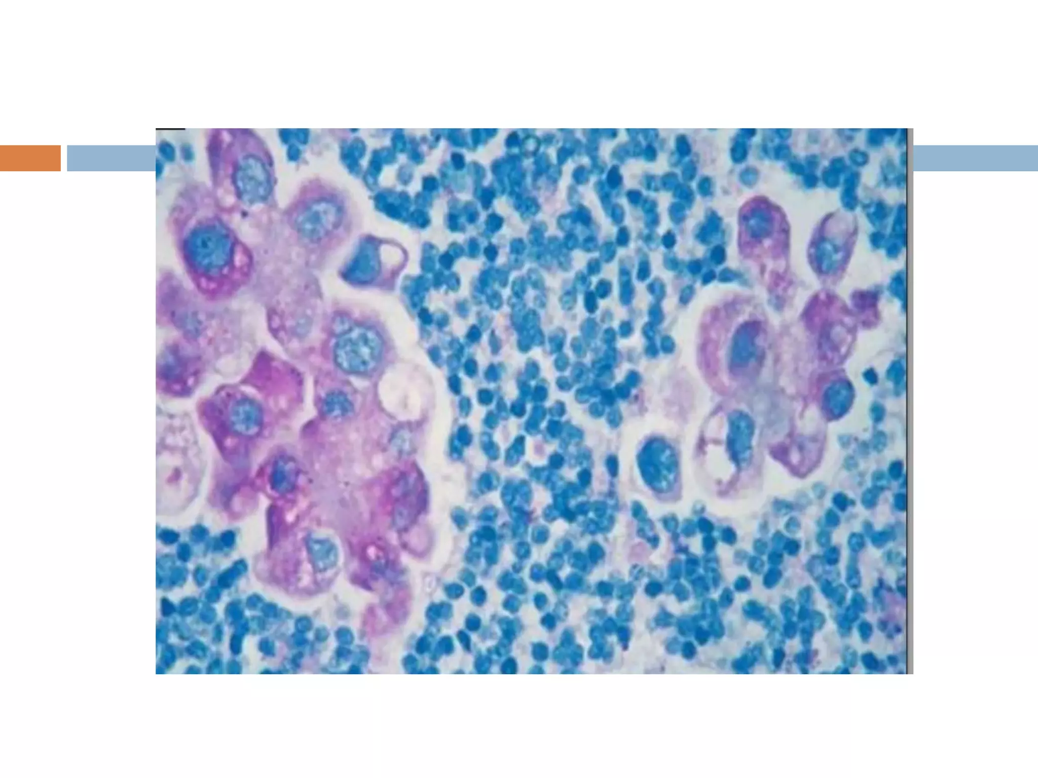 Special stains in cytology | PPTX
