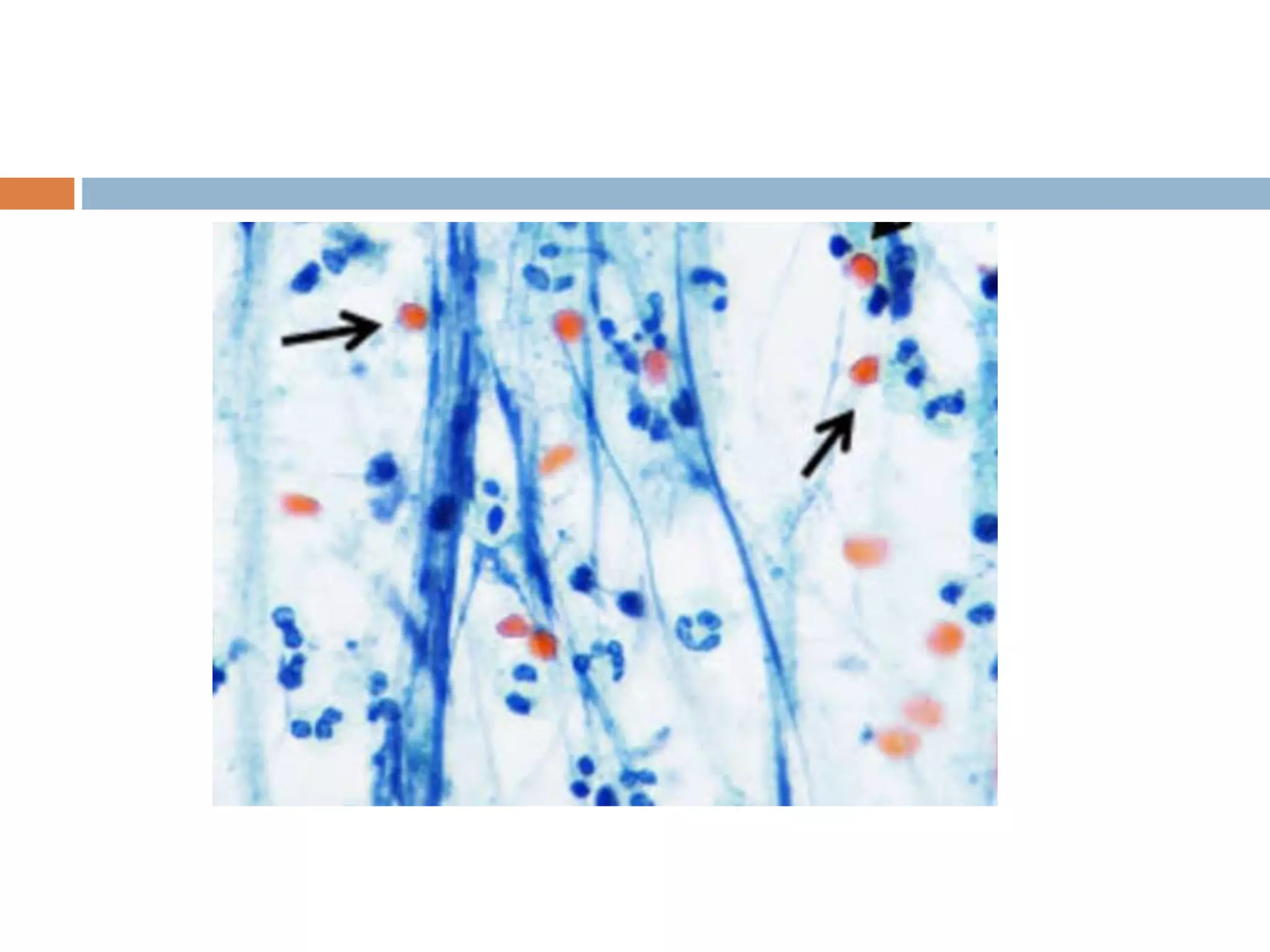 Special stains in cytology | PPTX