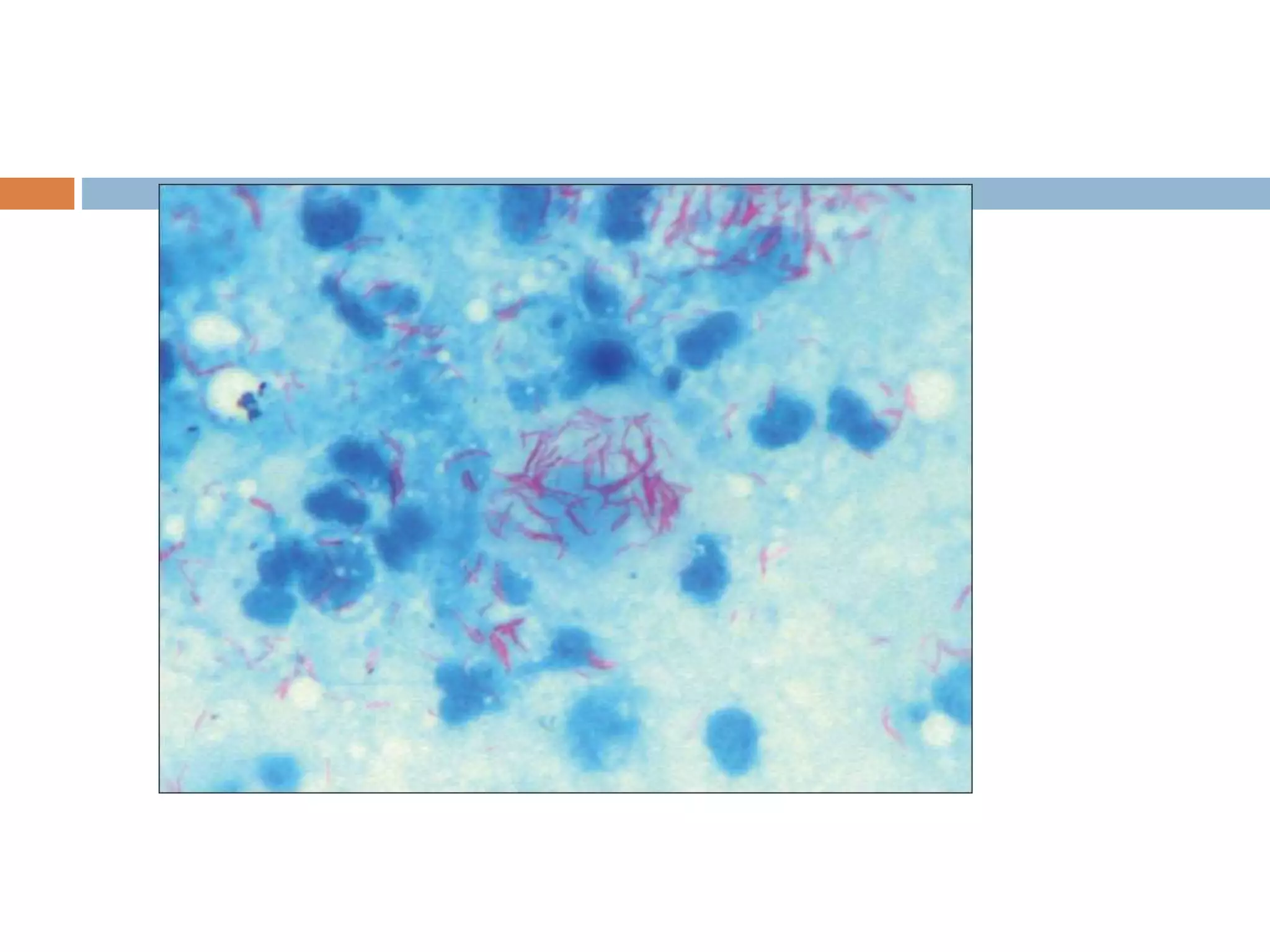 Special stains in cytology | PPTX