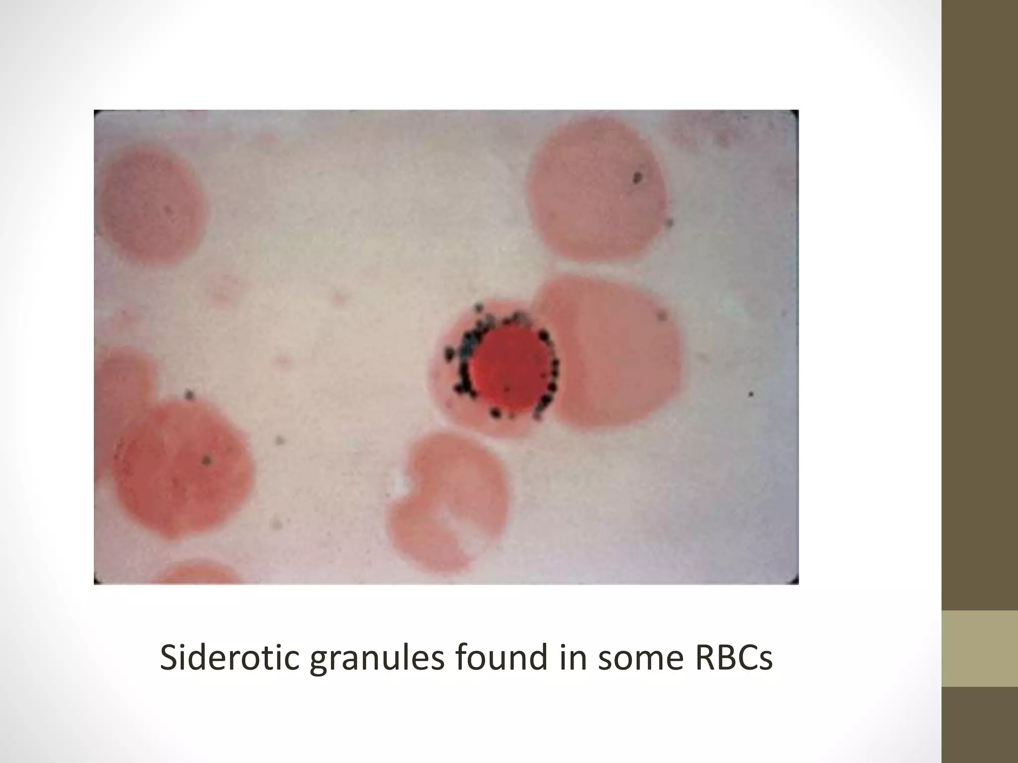 Special stains in hematology | PPTX