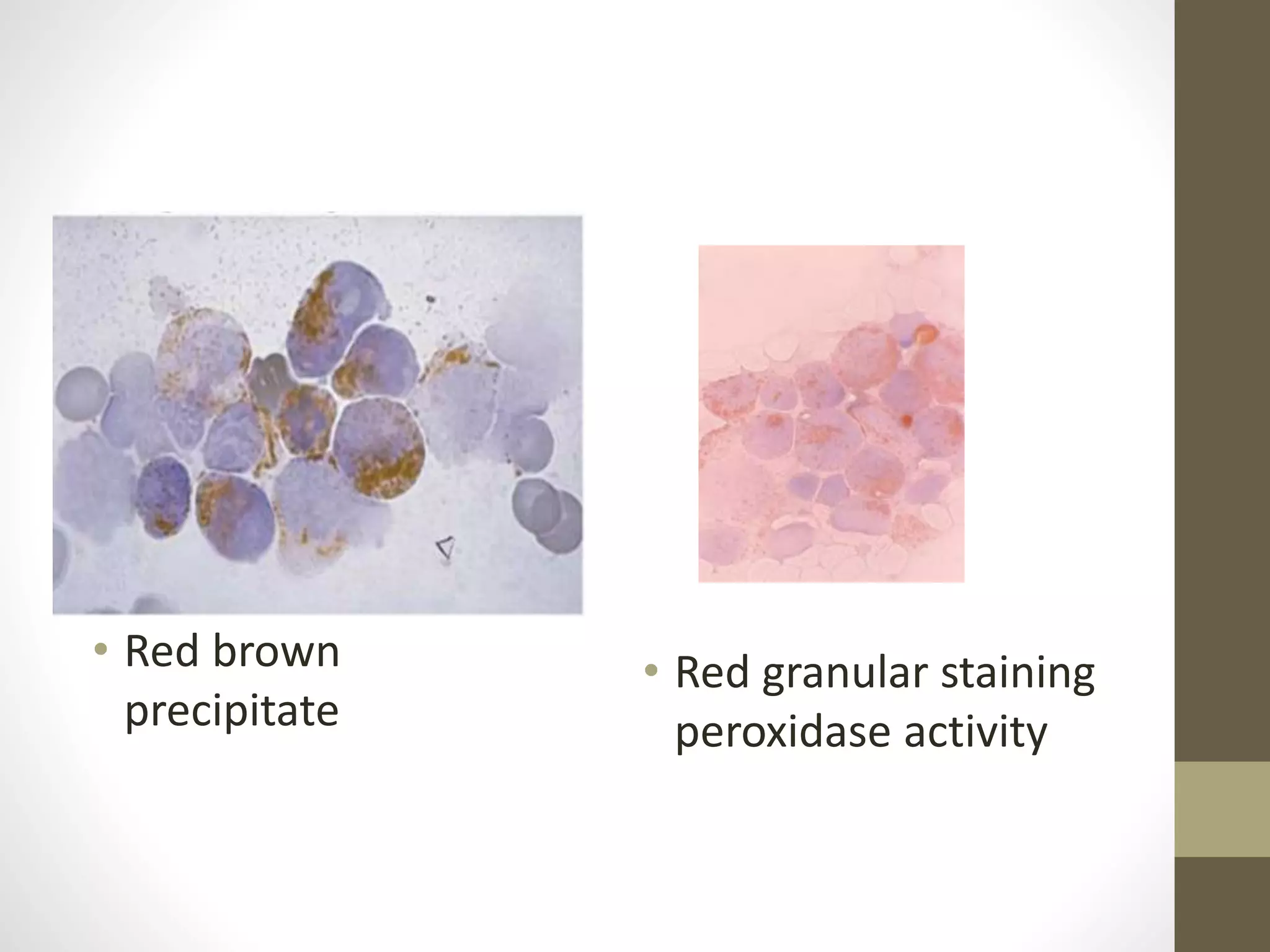 Special stains in hematology | PPTX
