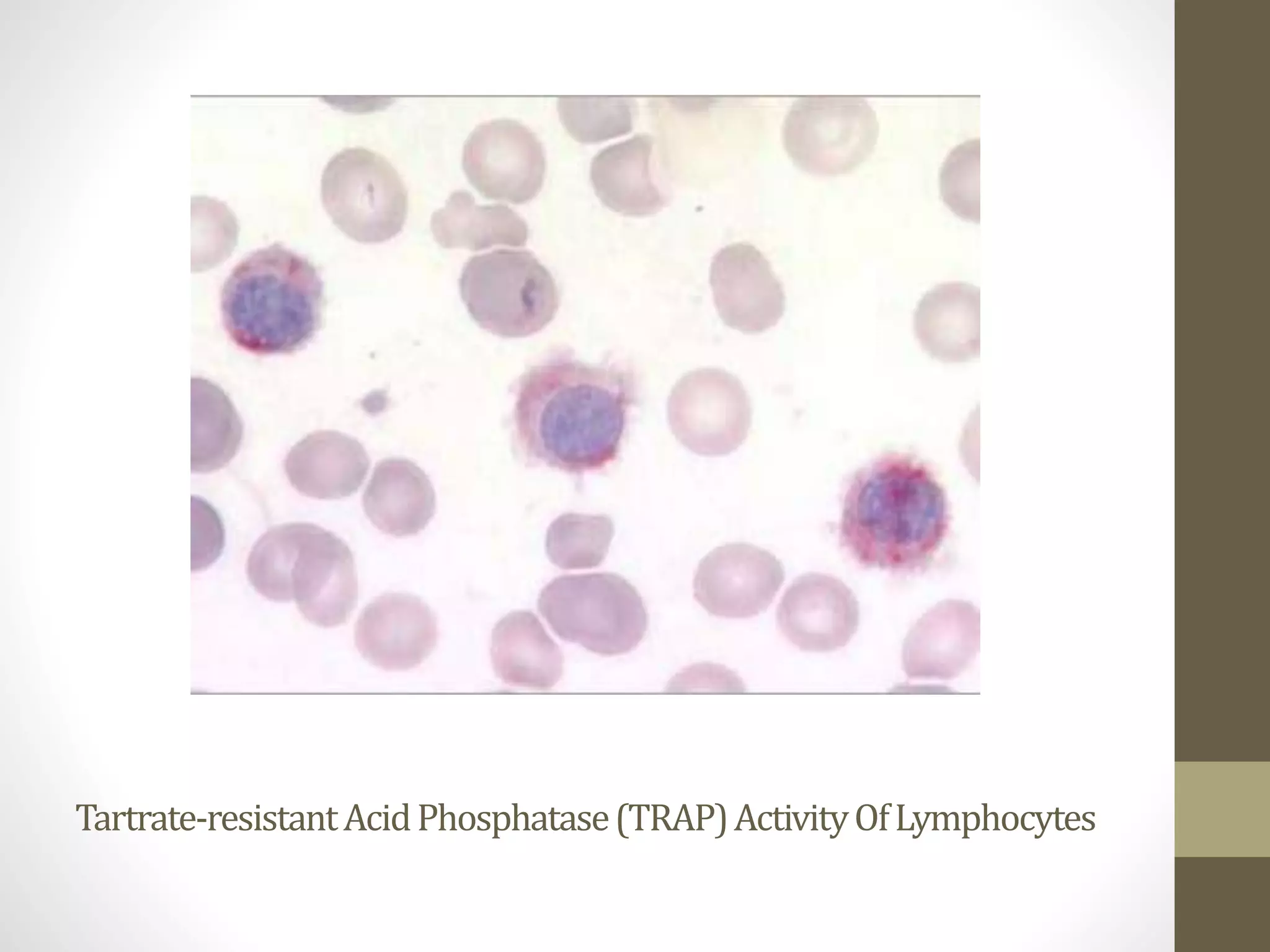 Special stains in hematology | PPTX