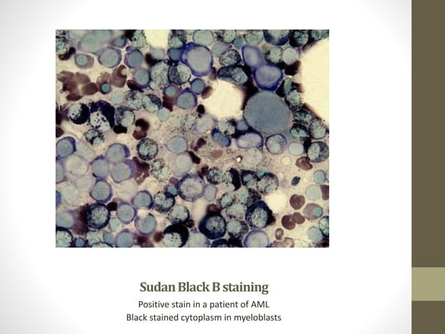 Special stains in hematology | PPTX