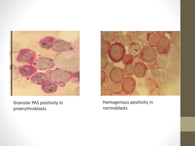 Special stains in hematology | PPTX