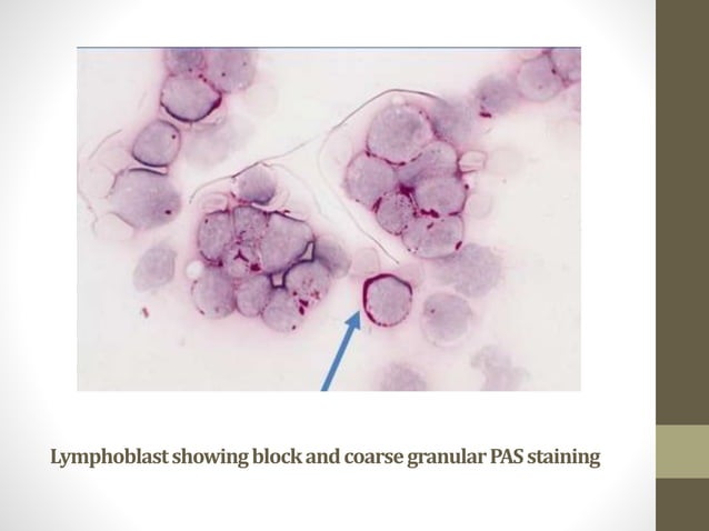 Special stains in hematology | PPTX