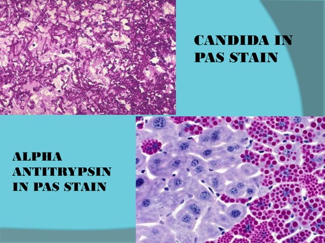 Special stains in histopathology | PPTX | Chemistry | Science