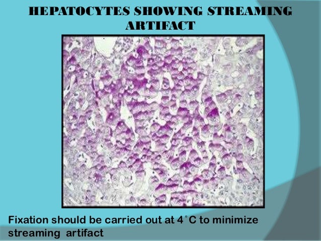 Special stains in histopathology