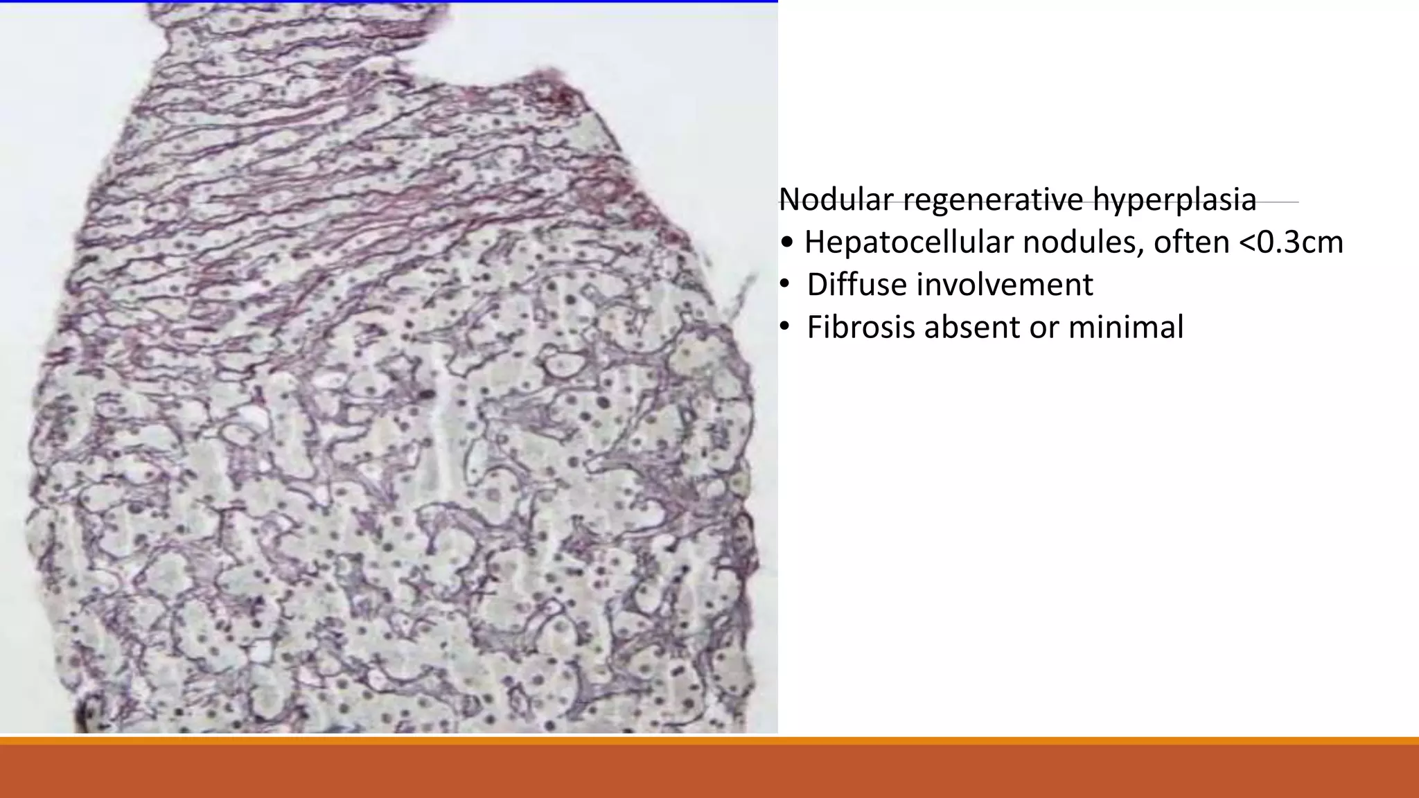 SPECIAL STAINS USED IN DIAGNOSING LIVER PATHOLOGY | PPTX