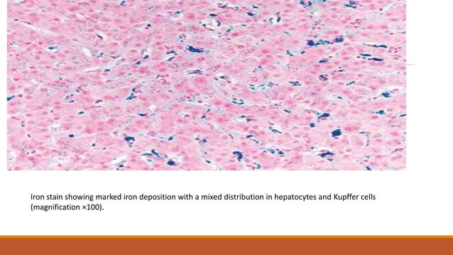 SPECIAL STAINS USED IN DIAGNOSING LIVER PATHOLOGY | PPTX | Blood ...