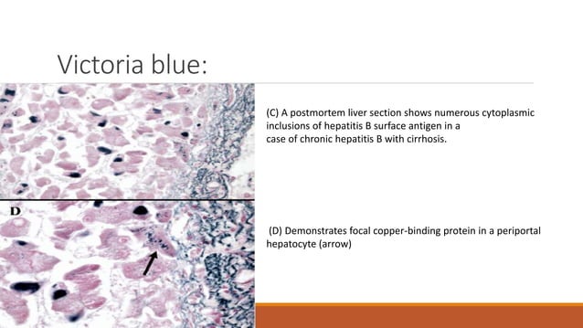 SPECIAL STAINS USED IN DIAGNOSING LIVER PATHOLOGY | PPTX | Blood ...