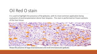SPECIAL STAINS USED IN DIAGNOSING LIVER PATHOLOGY | PPTX