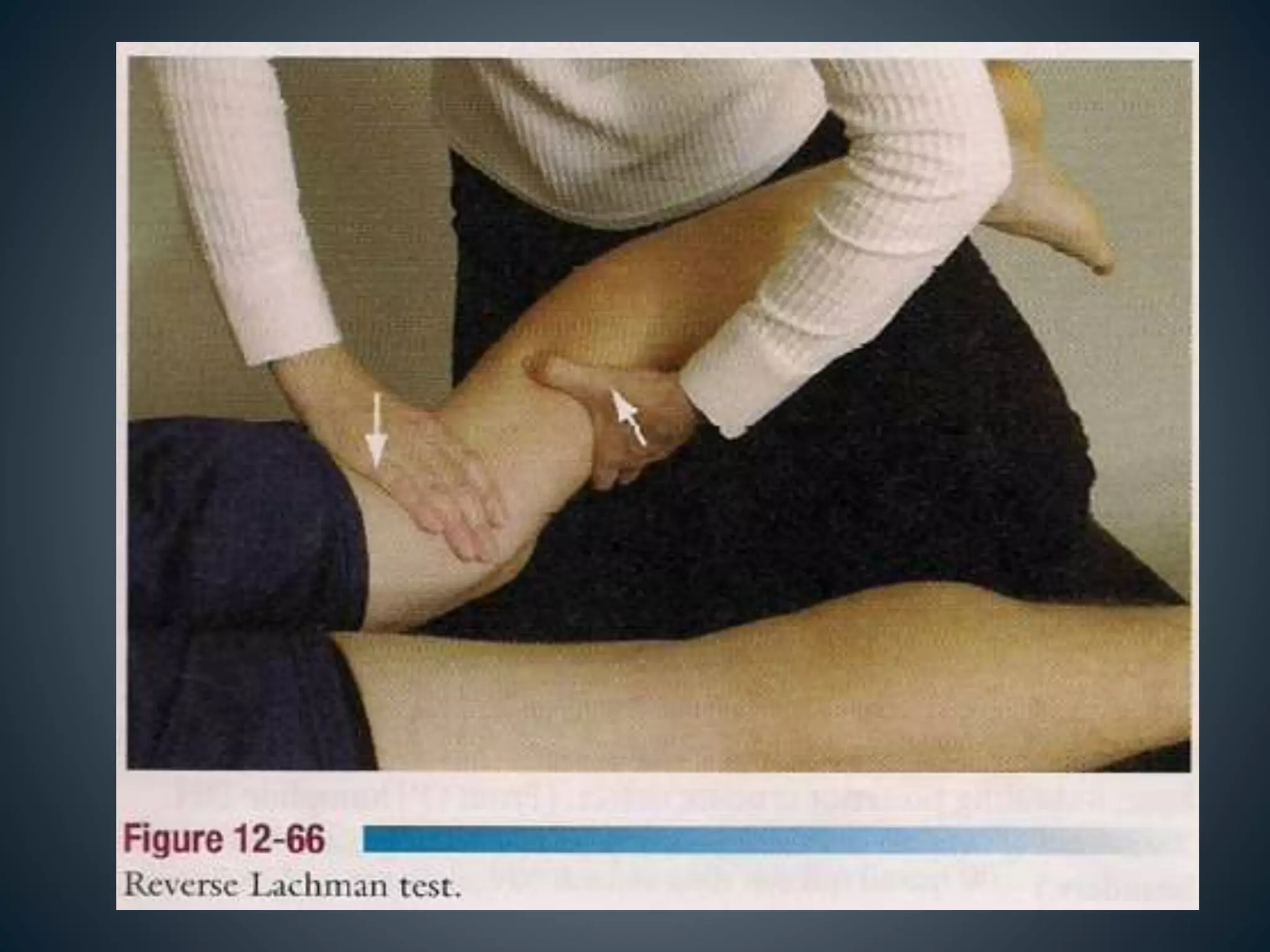 Special Tests - Knee | PPTX