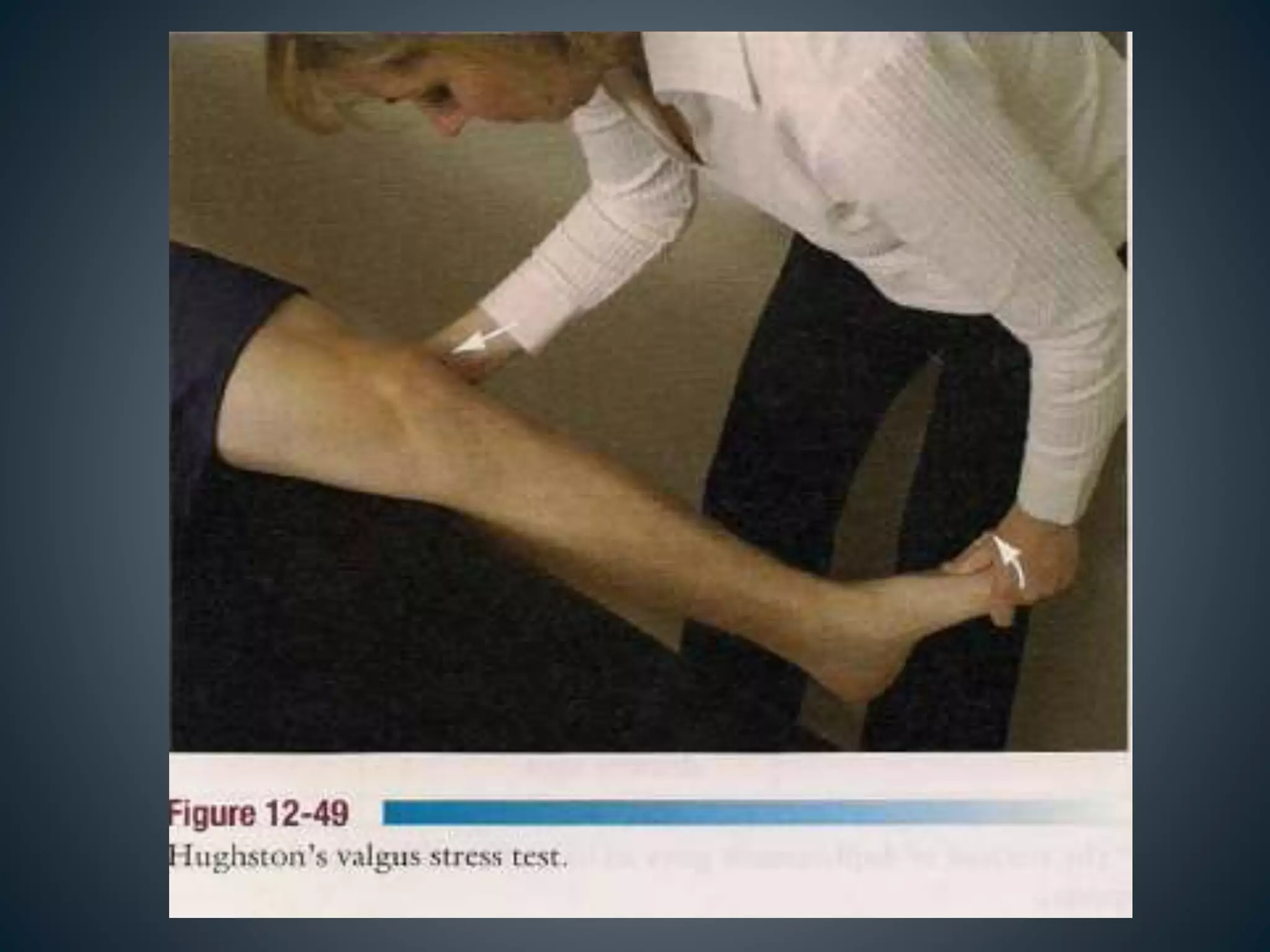 Special Tests - Knee | PPTX