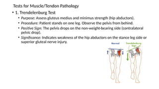 Special test for Hip joint and hip pathology | PPTX