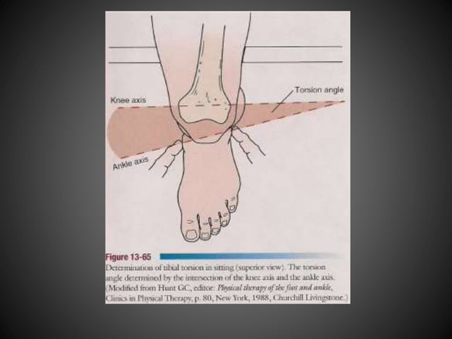 Special Tests for Lower Leg, Ankle, and Foot | PPTX | Death, Injury, or ...
