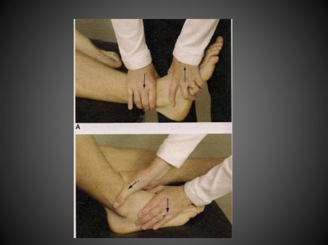 Special Tests for Lower Leg, Ankle, and Foot | PPTX | Death, Injury, or ...