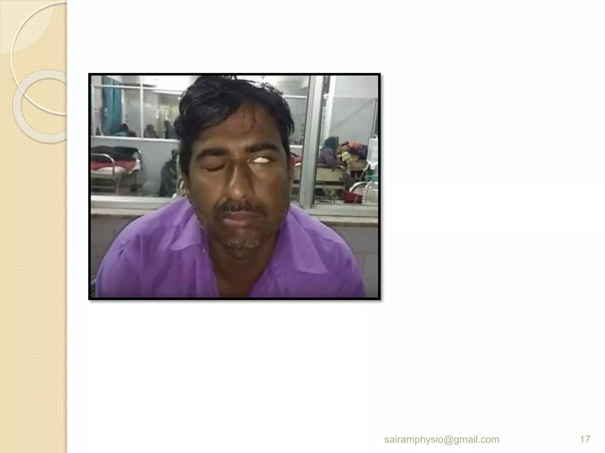 Neurological special tests.pptx