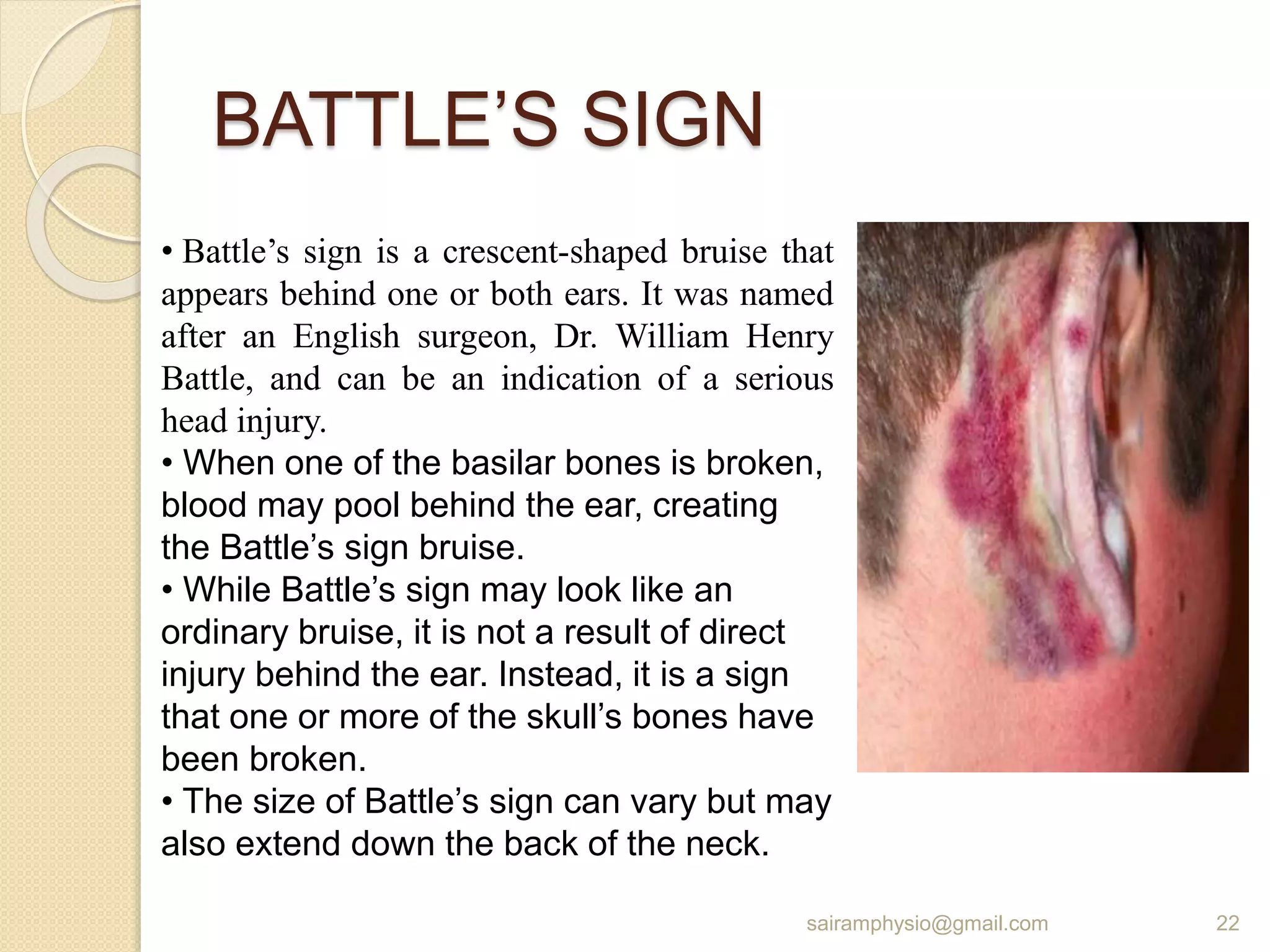 Neurological special tests.pptx