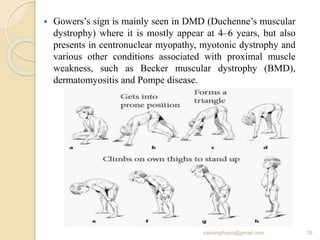 Neurological special tests.pptx